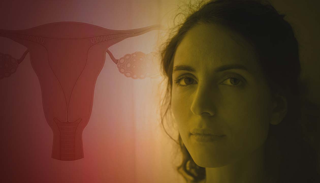 Essure Lawsuit - Join the Many